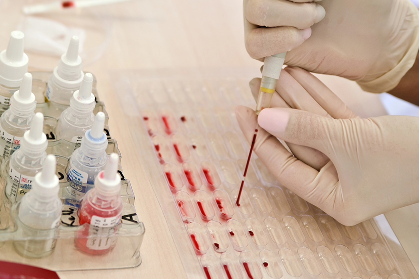 Blood Type: Understanding Potential Links To Dementia Risk - Discovery ...